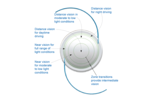 Cataract Surgery: Which is the better lens, Multifocal or Monofocal ...